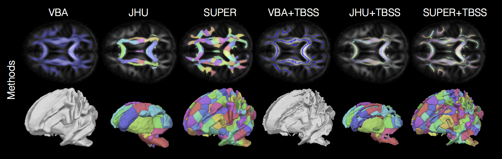A Comparative evaluation of voxel-based spatial mapping in diffusion tensor imaging | Ryan Cabeen