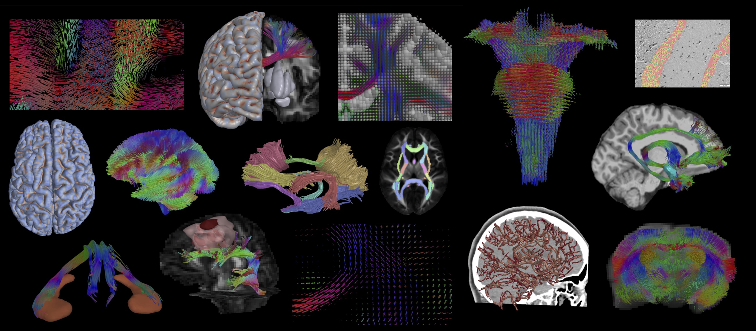 Quantitative Imaging Toolkit: Software for Interactive 3D Visualization ...